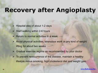 Facts on Angioplasty | PDF