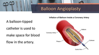 ANGIOPLASTY.pptx