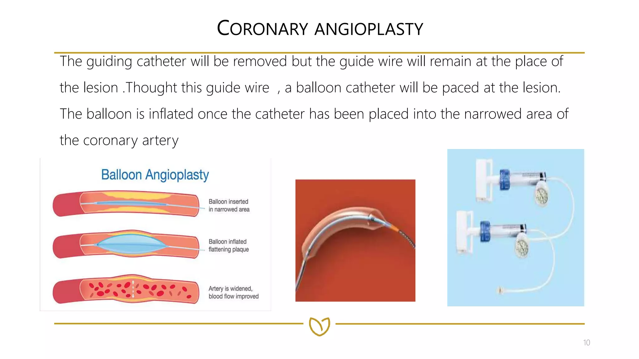 ANGIOPLASTY (1).pptx