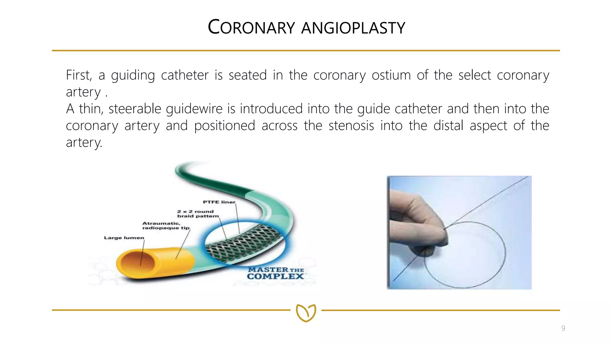 ANGIOPLASTY (1).pptx