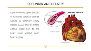 ANGIOPLASTY (1).pptx