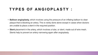 angioplasty in heart disease's | PPTX