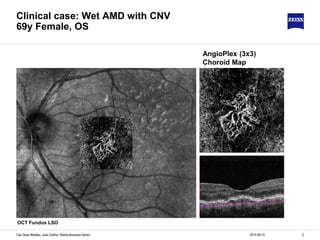 Angio plex clinical_cases OCTA AJAY DUDANI | PPTX