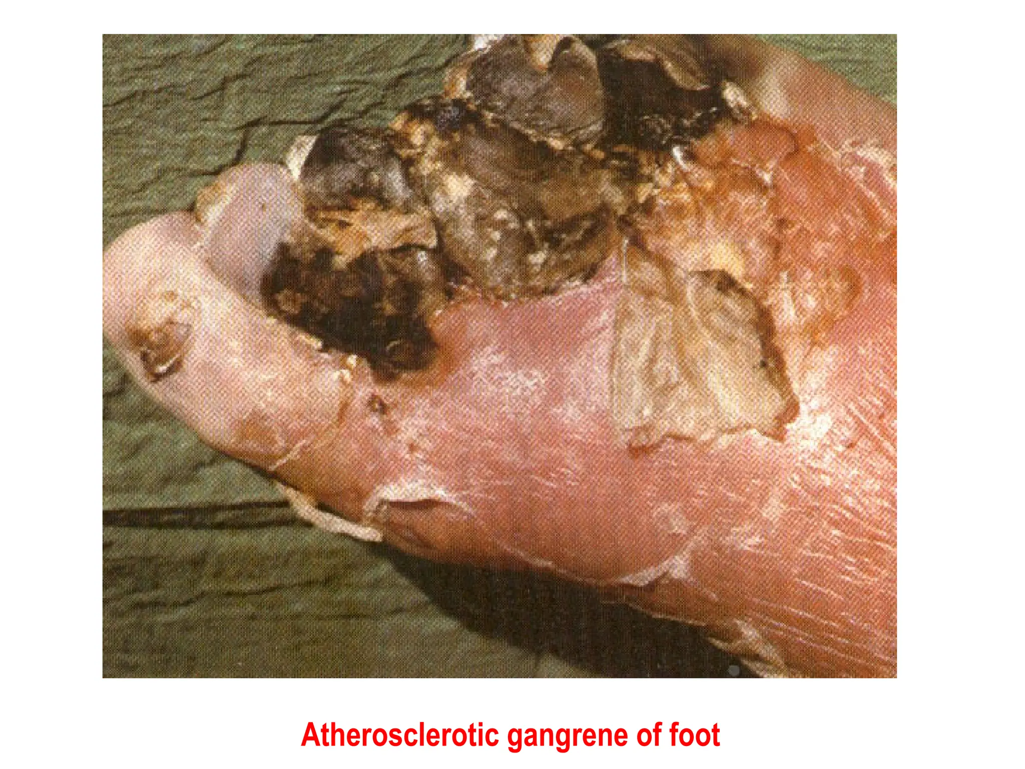 Angioprotectors ( details of drugs ).ppt