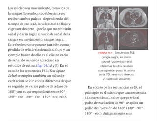 Angio RM.pdf