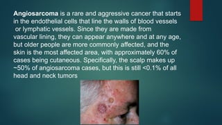 angiosarcoma cause, treatment , pathological facts | PPTX
