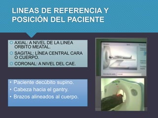 Angiotomografia | PPTX