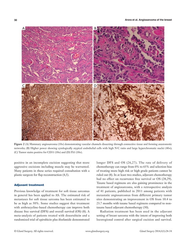 Angiosarcoma Review | PDF