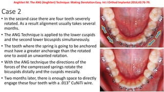 ANG JC.pptx | Dental Health | Diseases and Conditions