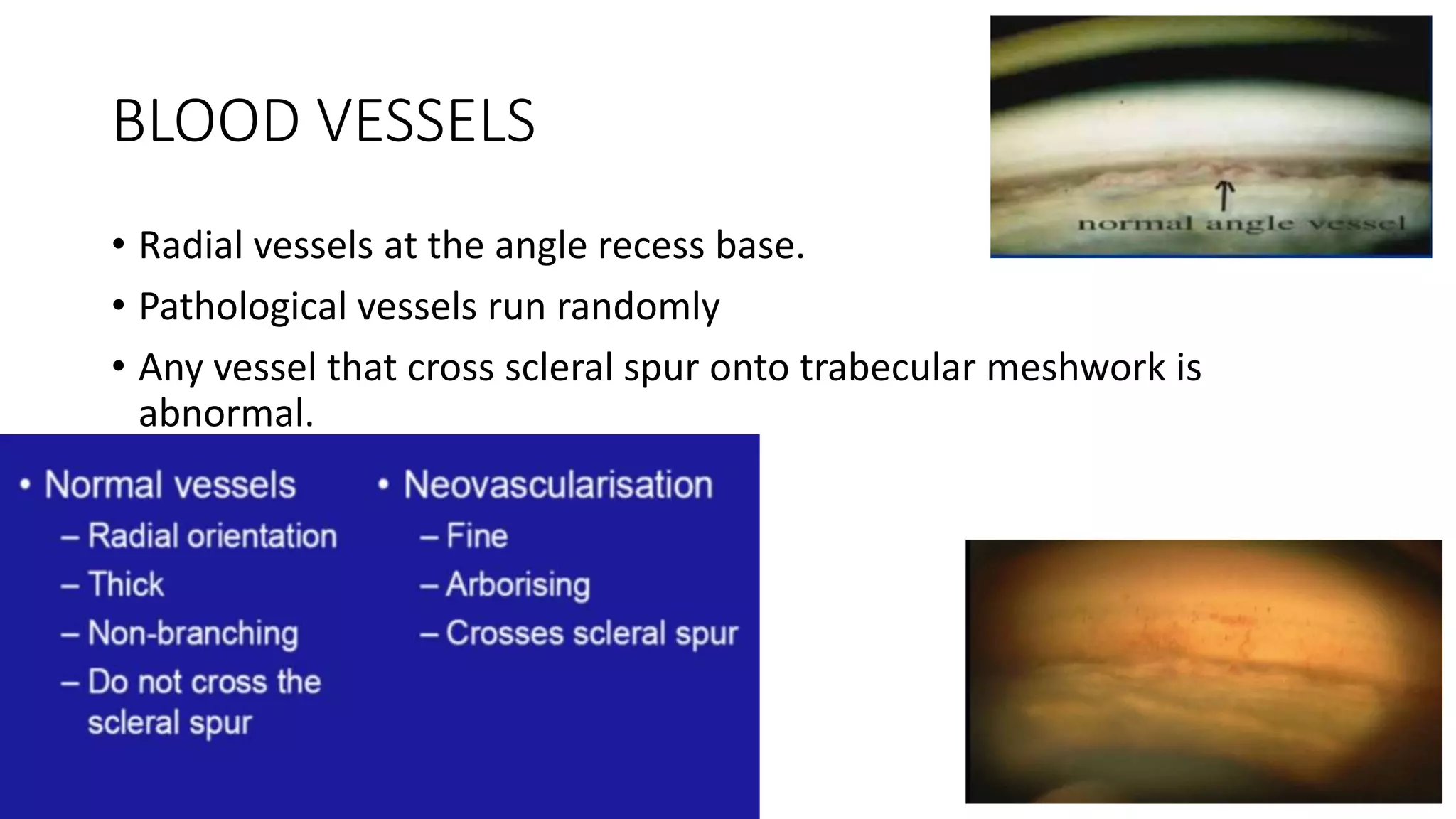 ANGLE ANATOMY | PPTX