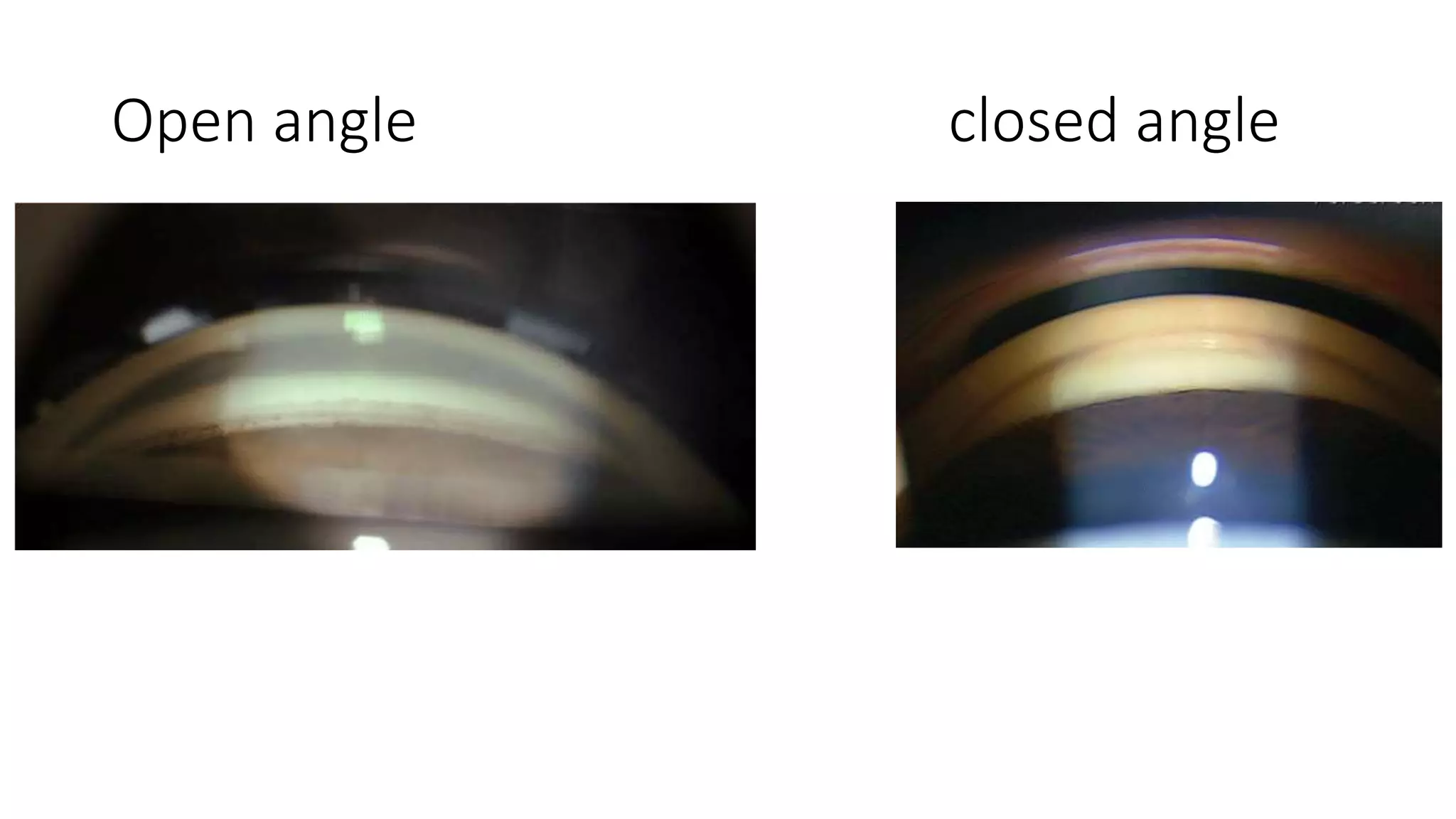 ANGLE ANATOMY | PPTX