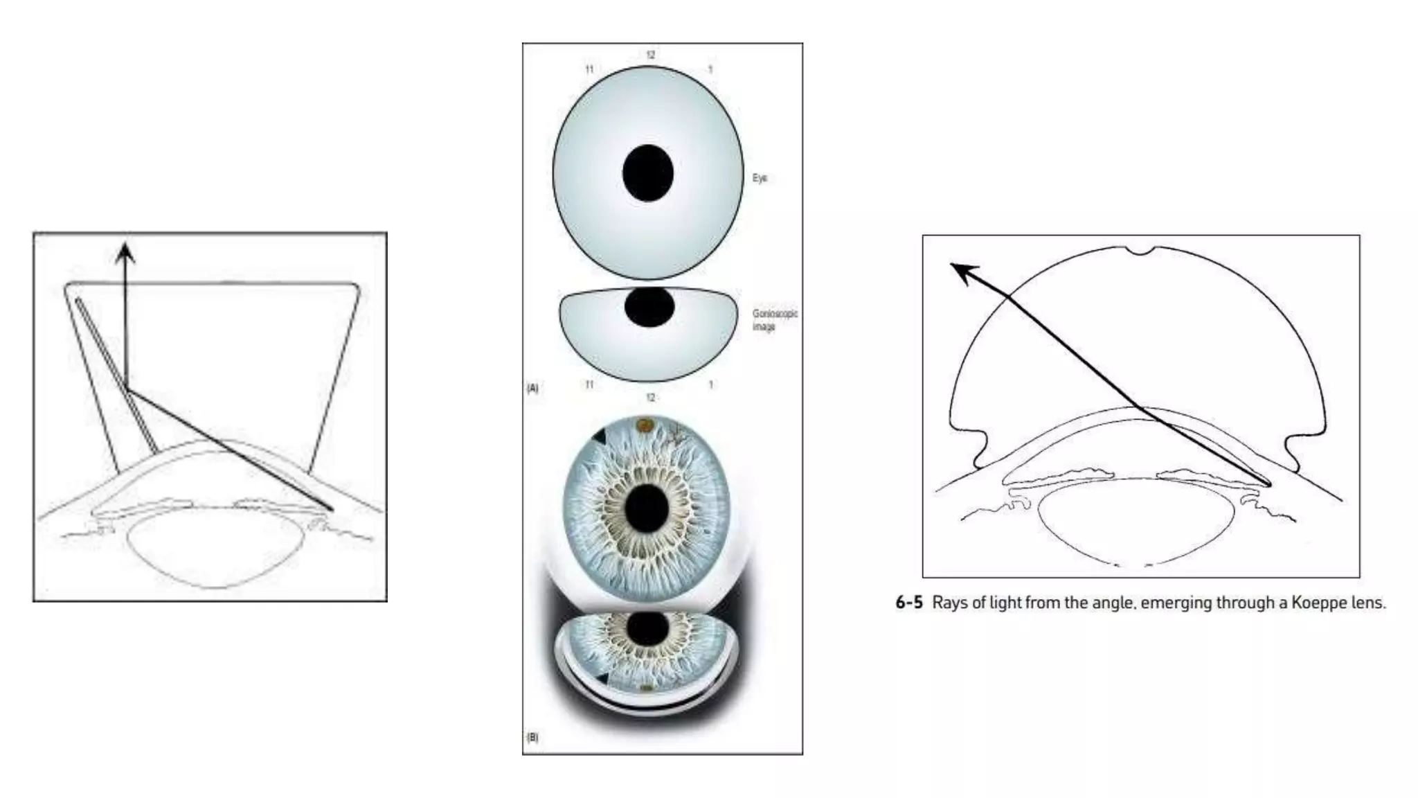 ANGLE ANATOMY | PPTX
