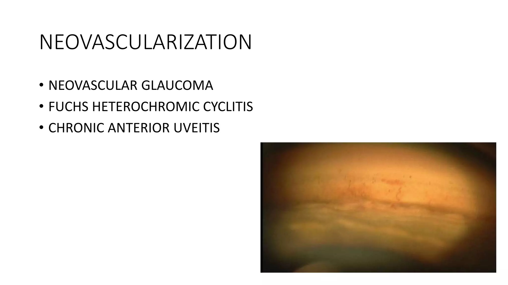 ANGLE ANATOMY | PPTX