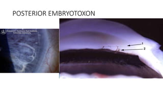ANGLE ANATOMY | PPTX