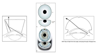 ANGLE ANATOMY | PPTX