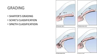 ANGLE ANATOMY | PPTX