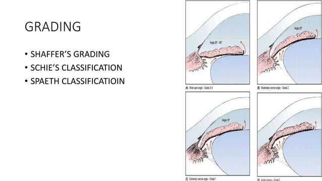 ANGLE ANATOMY | PPTX | Eye and Vision Conditions | Diseases and Conditions