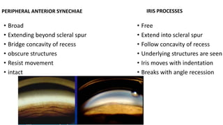 ANGLE ANATOMY | PPTX