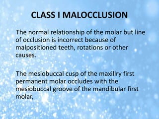 ANGLE'S CLASSIFICATION OF MALOCCLUSION | PPTX