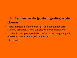 Angle closure glaucoma | PPTX