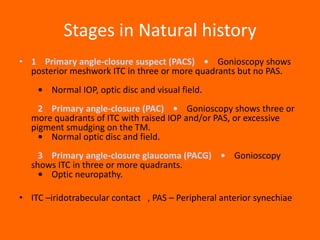 Angle closure glaucoma | PPTX