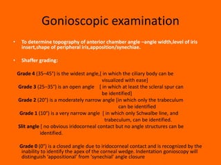 Angle closure glaucoma | PPTX