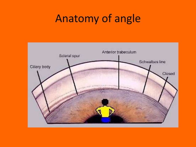 Angle closure glaucoma | PPTX