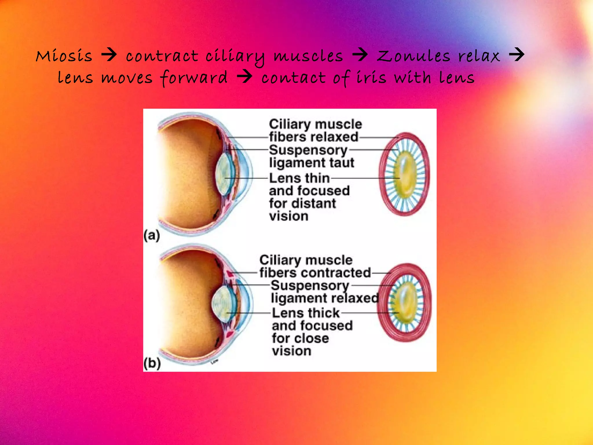 Angle closure glaucoma | PPT