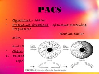 Angle closure glaucoma | PPT