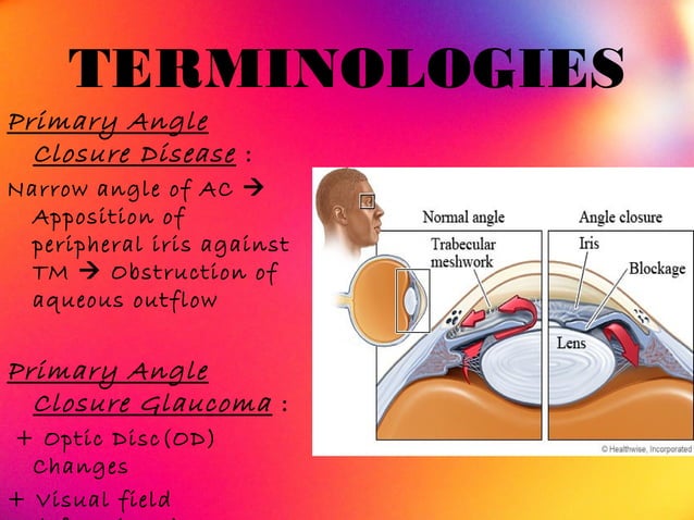 Angle closure glaucoma | PPT | Eye and Vision Conditions | Diseases and ...