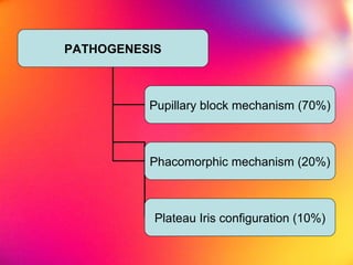 Angle closure glaucoma | PPT