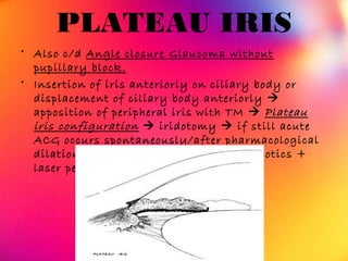 Angle closure glaucoma | PPT