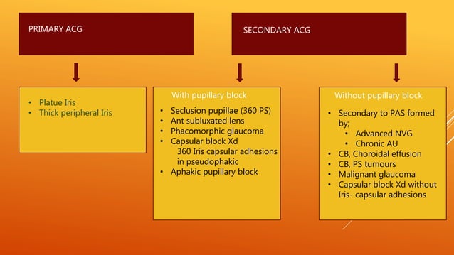 Angle closure glaucoma | PPT