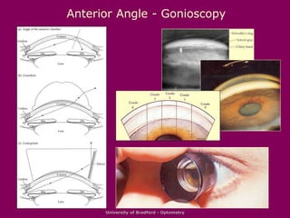Angle drainage | PPT