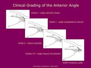 Angle drainage | PPT
