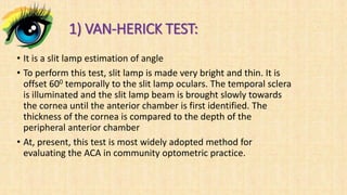 Angle of anterior chamber | PPTX