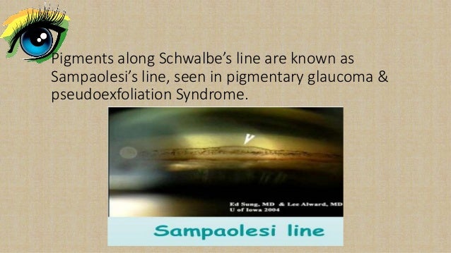 Angle of anterior chamber