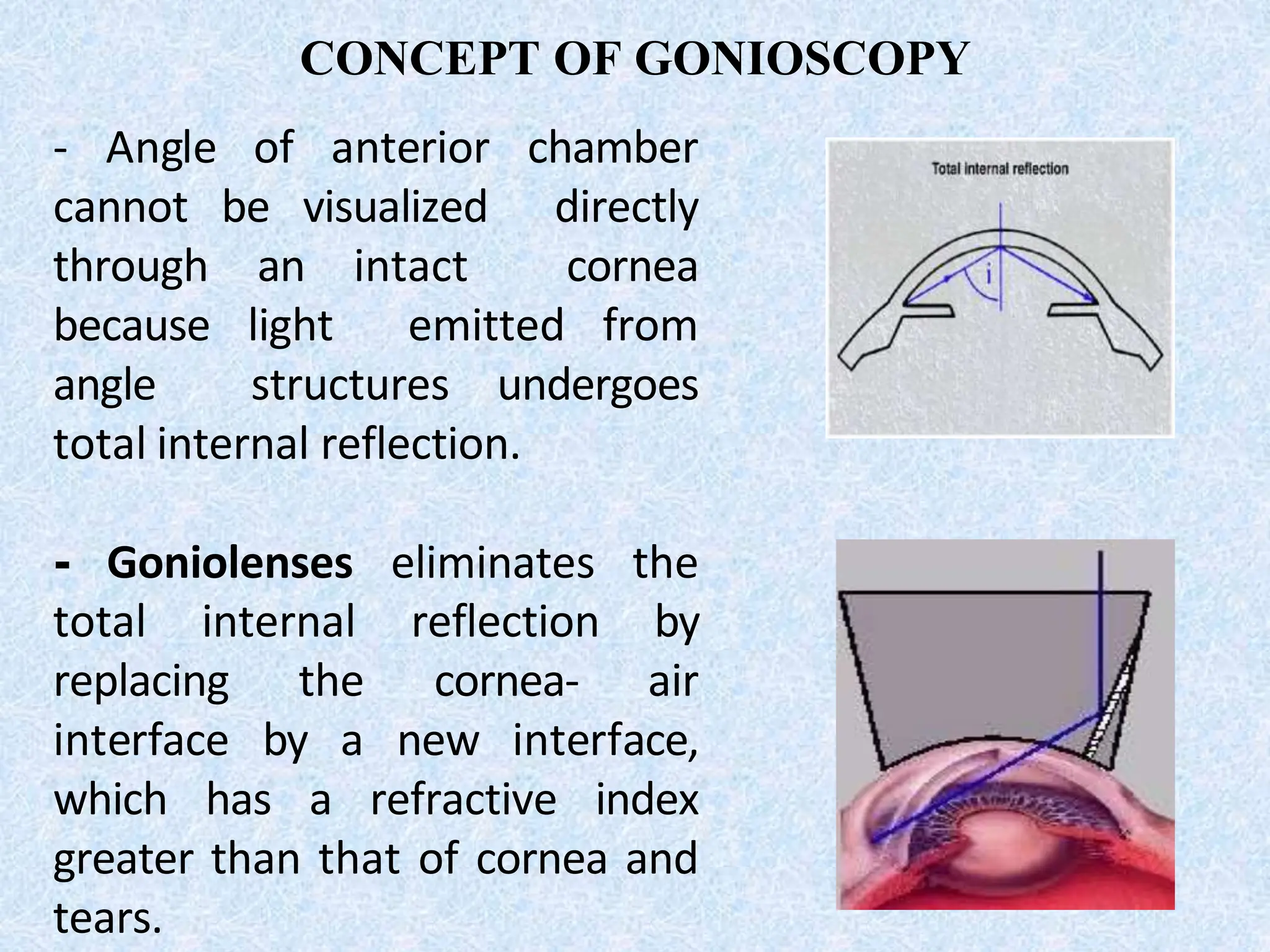 Angle of Anterior Chamber smch.......... | PPTX