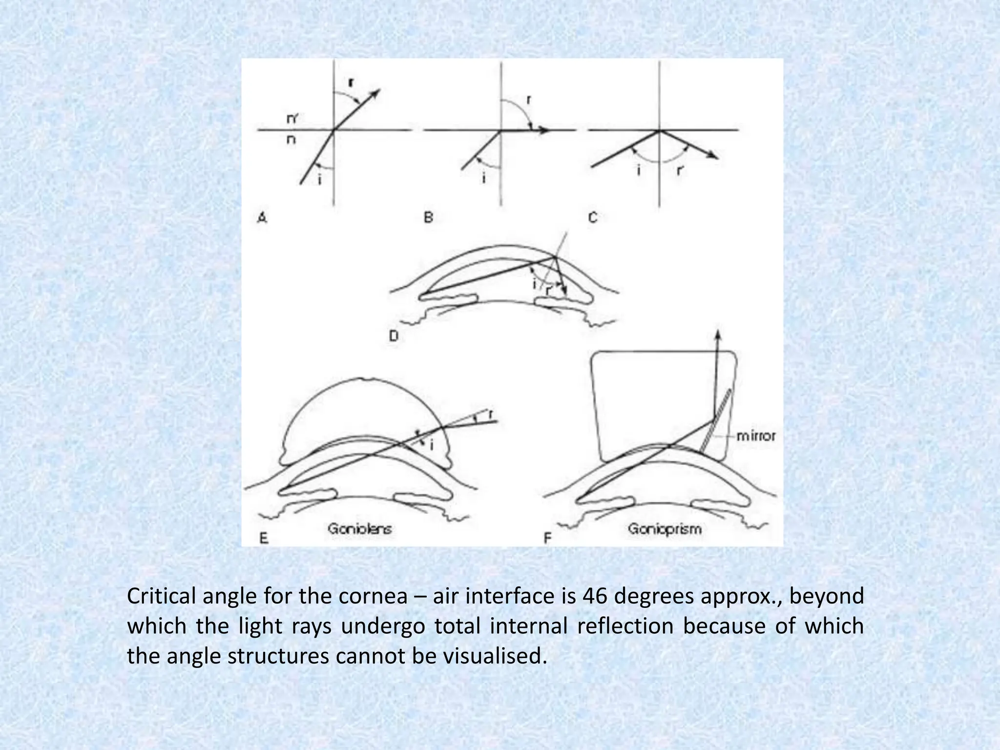 Angle of Anterior Chamber smch.......... | PPTX