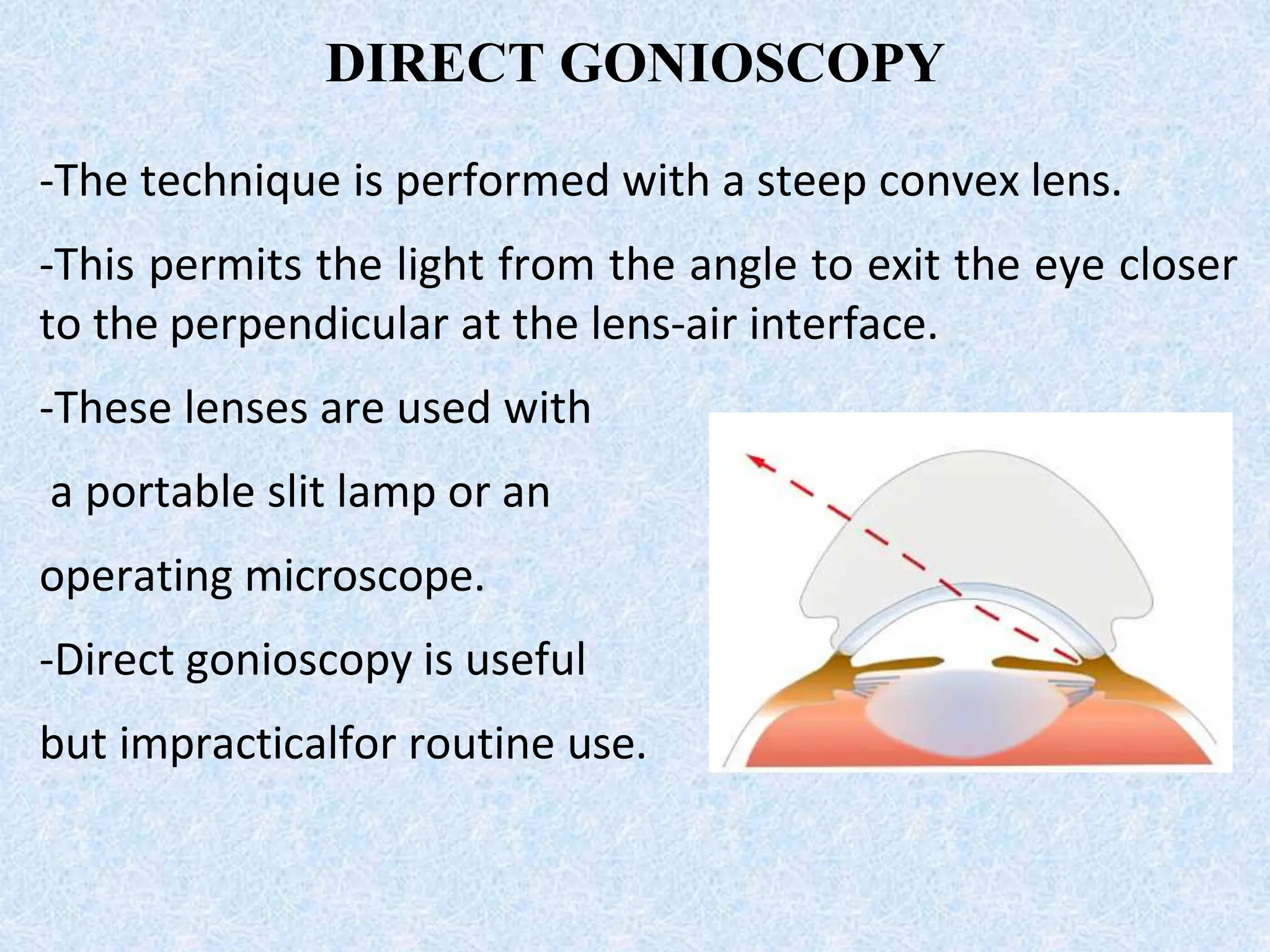 Angle of Anterior Chamber smch.......... | PPTX