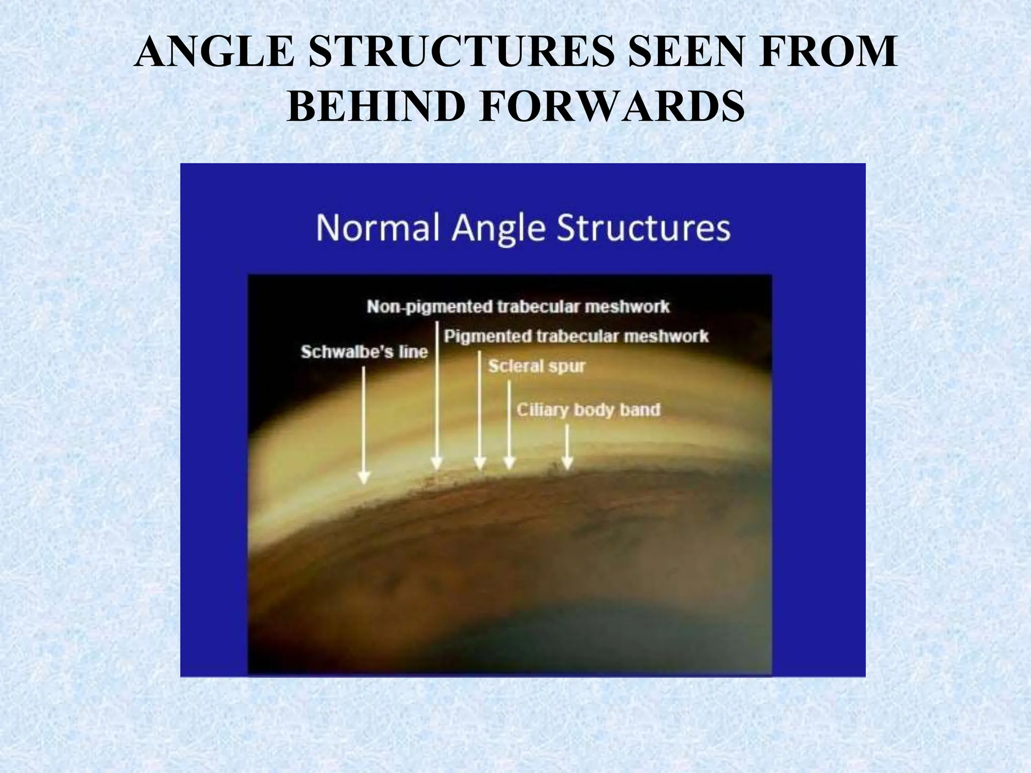 Angle of Anterior Chamber smch.......... | PPTX