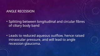 Angle of anterior chamber (2).presentation | PPTX
