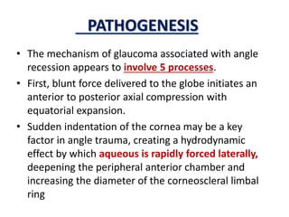 Angle recession glaucoma | PPTX