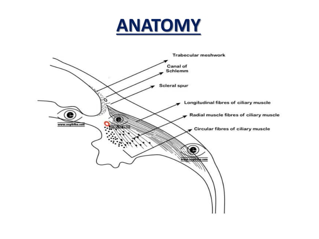 Angle recession glaucoma