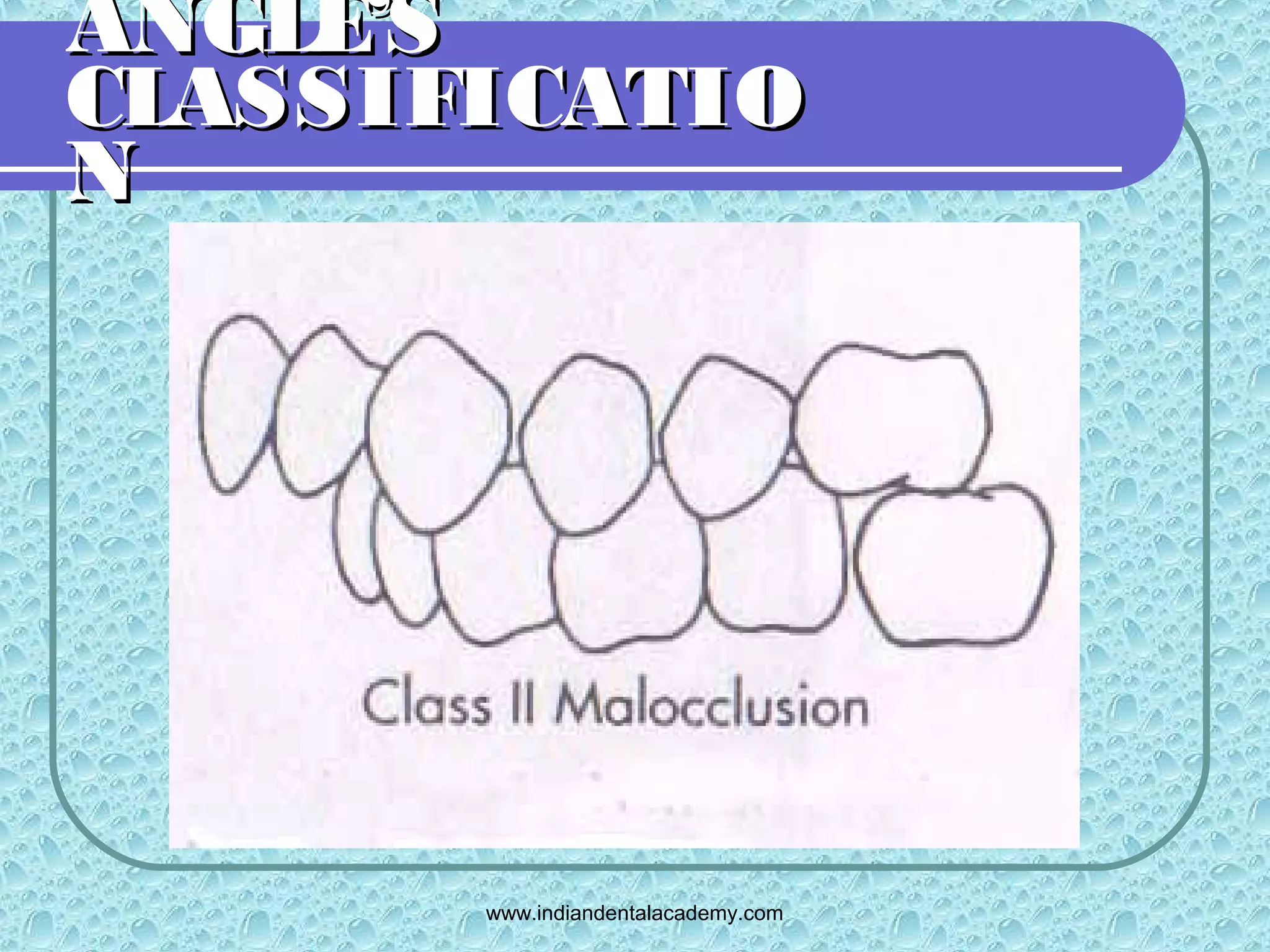 Angles classification /certified fixed orthodontic courses by Indian ...