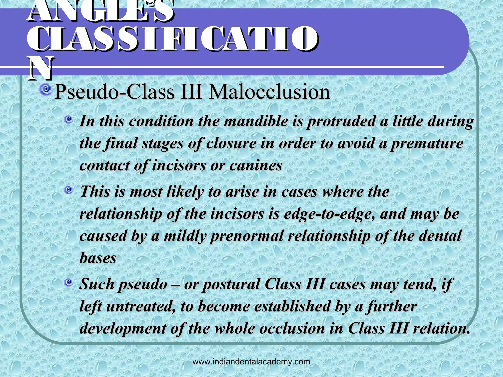 Angles classification /certified fixed orthodontic courses by Indian ...