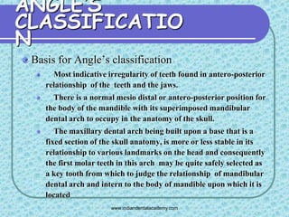 Angles classification & its shortcoming 2 /certified fixed orthodontic ...