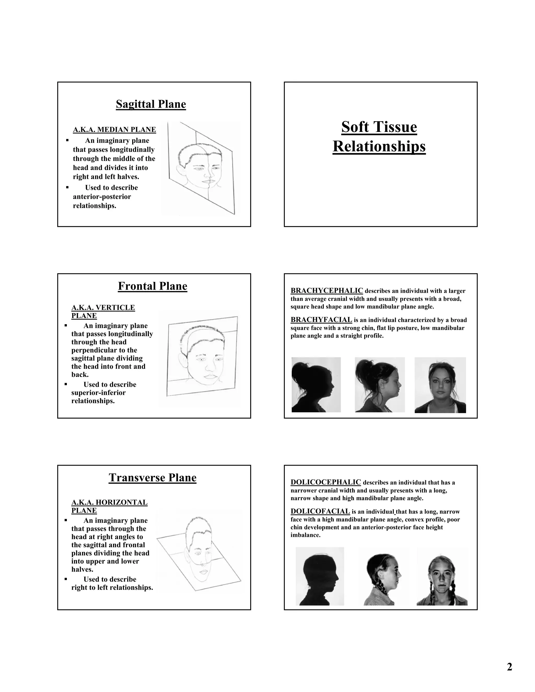 Angle's classification of malocclusion | PDF