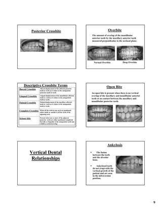 Angle's classification of malocclusion | PDF