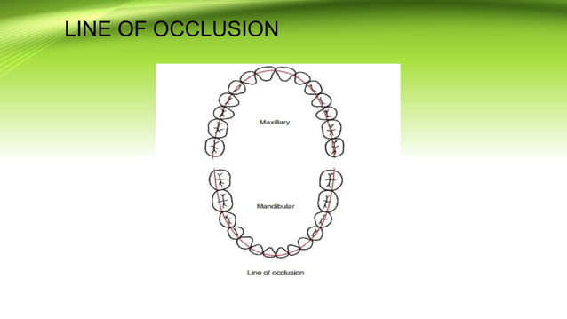 Angle’s classification of malocclusion. (2).pptx